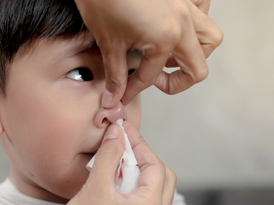 A Parent's Guide to Understanding Nosebleeds