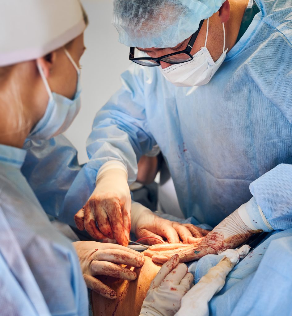 Natural Birth vs C-section: What You Need to Know